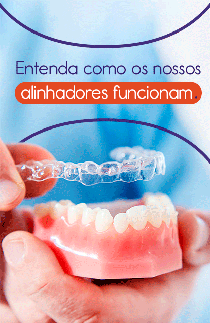 X Aligner - Especialistas em sorrisos