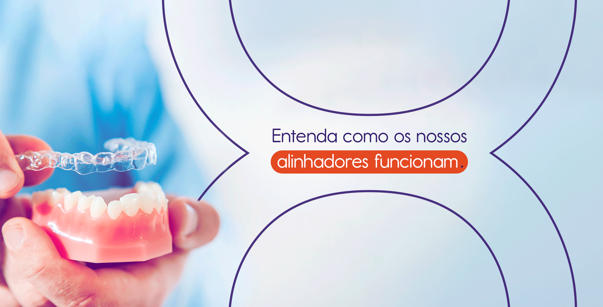 X Aligner - Especialistas em sorrisos